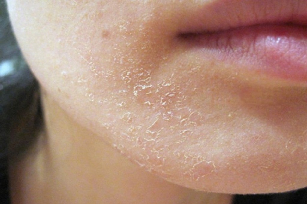 Powder vs. Liquid Foundation: What's the Difference & Which Should M ...