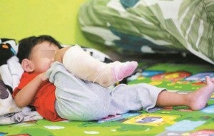2yo Boy Risks Amputation After Insect Bite on Leg Gets Infected with ...