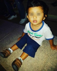 2yo Boy Risks Amputation After Insect Bite on Leg Gets Infected with ...