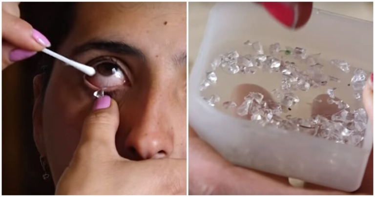 This Woman Actually Cries Sparkling "Crystal" Tears & Experts Have No Idea Why - WORLD OF BUZZ