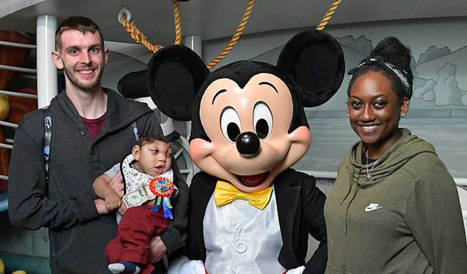 Miracle Baby Celebrates 1st Birthday Despite Being Born Without Top of ...