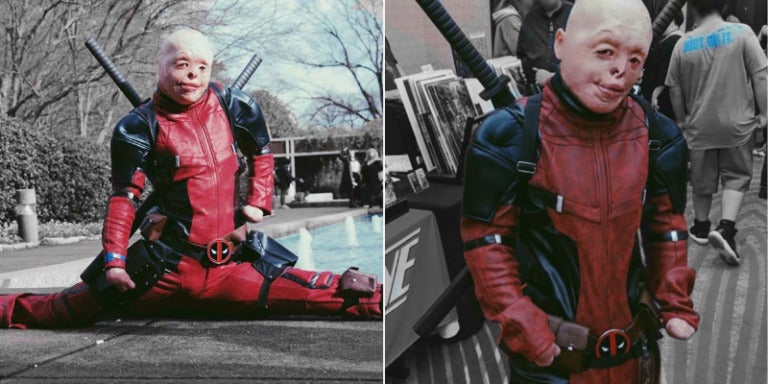 Burn Victim Learns How To Split To Cosplay As Deadpool, Ryan Reynolds ...