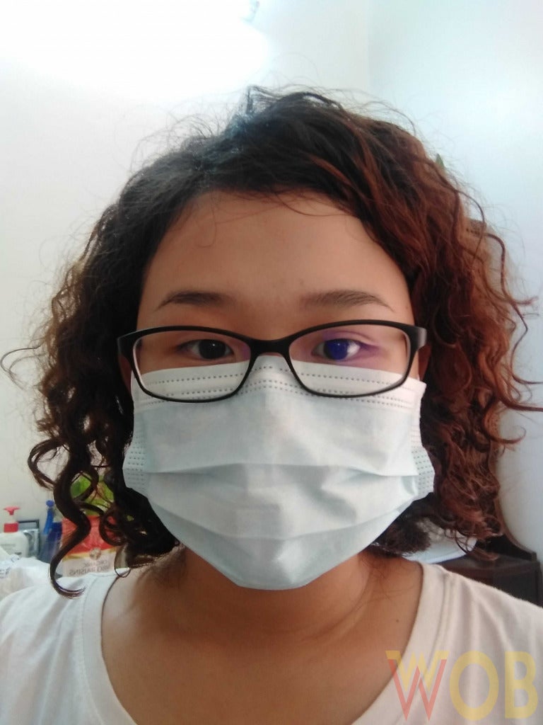 Does Twisting Your Mask's Straps Stop Your Glasses From Fogging Up? We ...