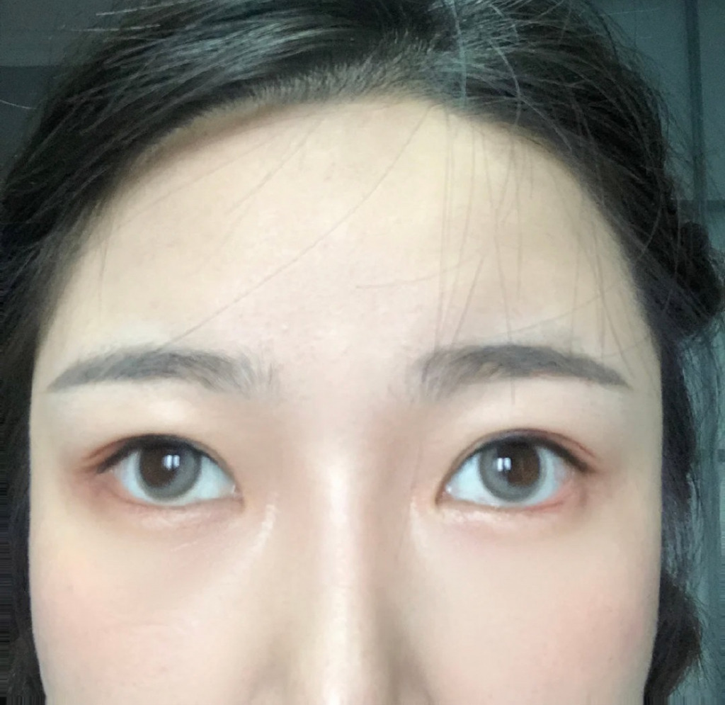 Expectations VS Reality: Netizens In China Buy Viral Contact Lenses ...