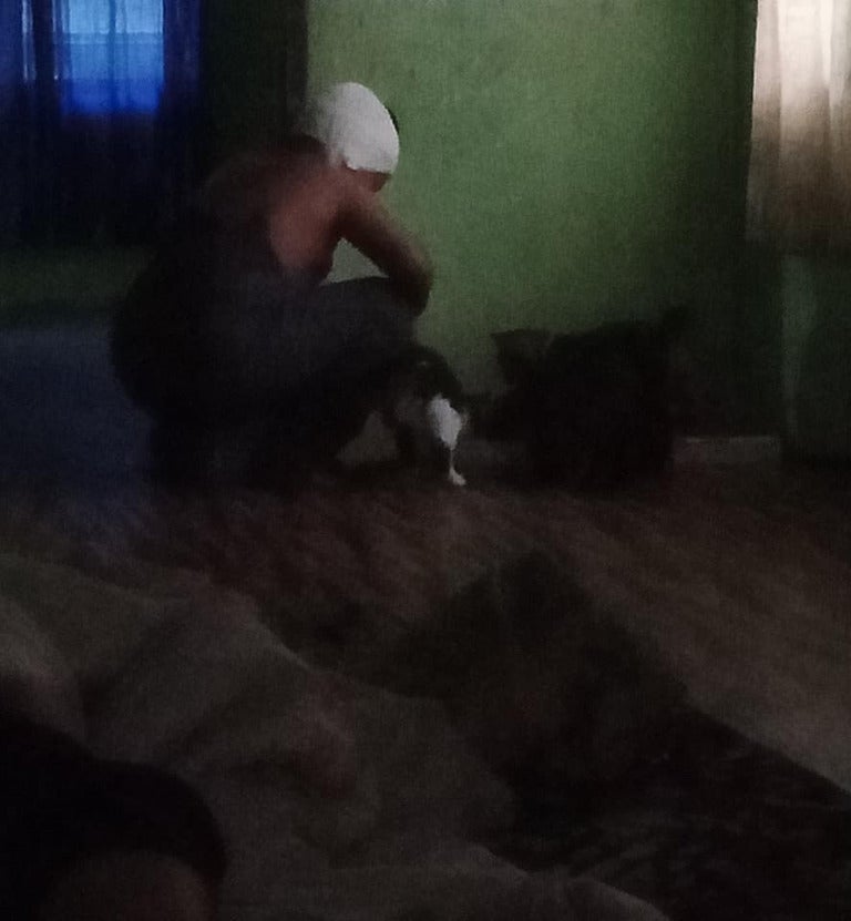 M'sian Boy's Face Severely Scratched Up By Cat, But He Still Loves Them ...
