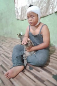 M'sian Boy's Face Severely Scratched Up By Cat, But He Still Loves Them ...