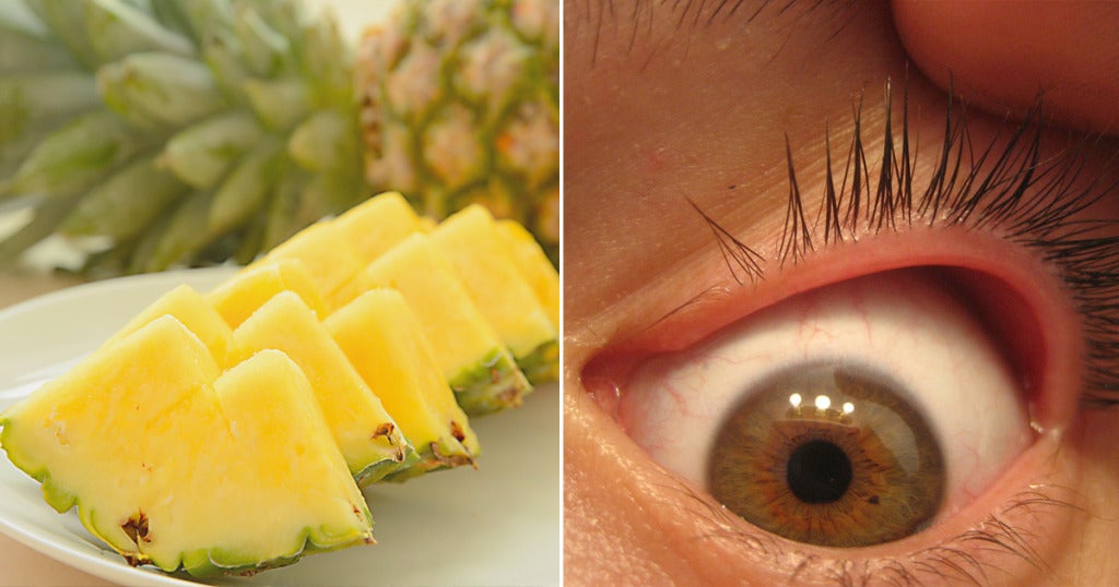 Not Just For Wealth & Prosperity, Here Are 7 Health Benefits That ...