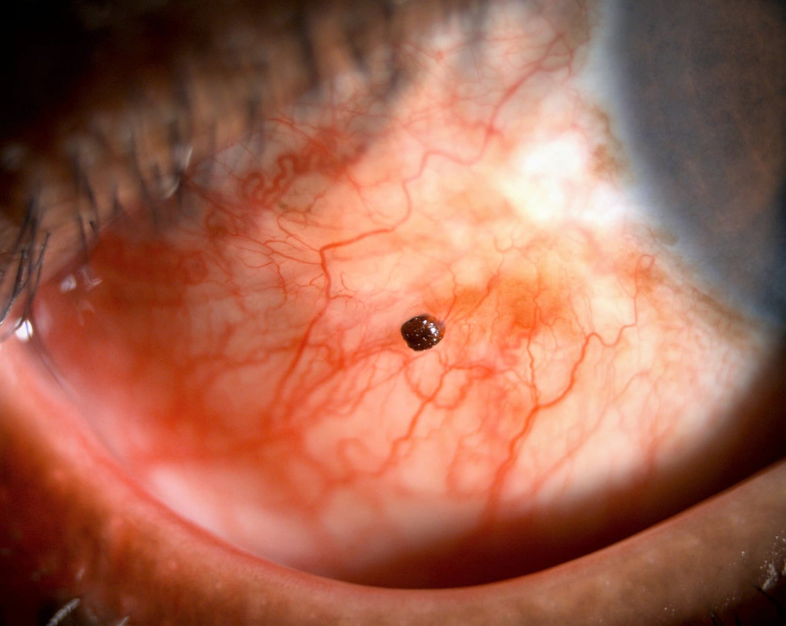 M'sian Rubs Eye After Ant Goes In, Finds Out Its Head Was Stuck Inside ...