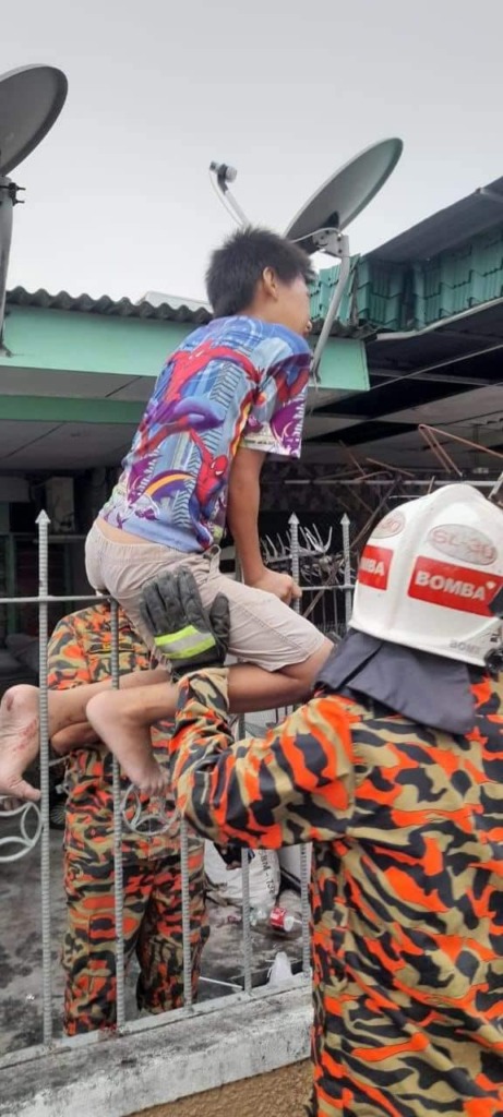 15cm Iron Metal Pierces Through 12yo Kid's Buttocks After He Slipped ...