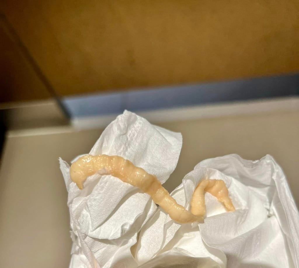 Japanese Man Gets Sick After Eating Raw Meat Dish in Thailand, Turns ...