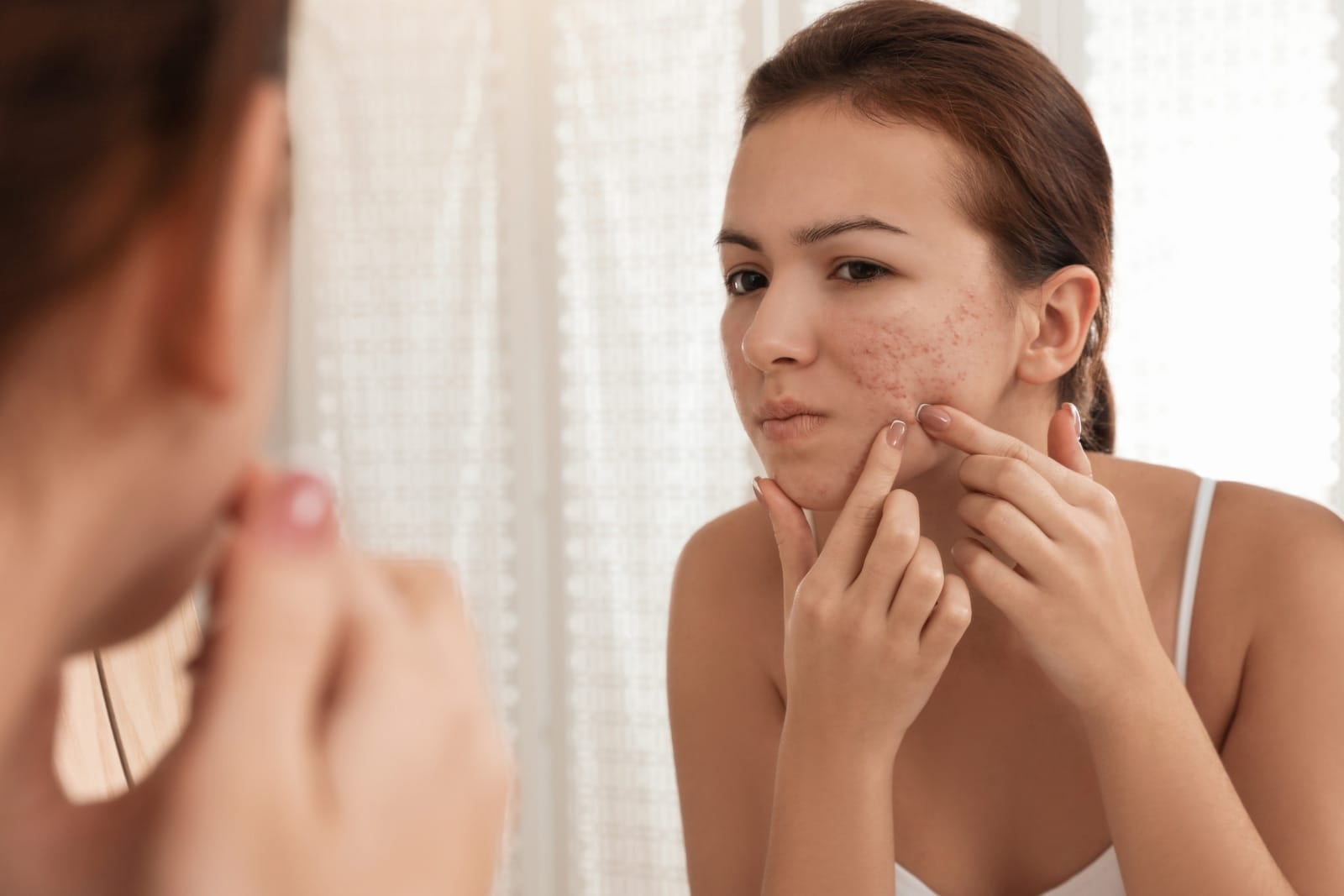 Breaking Out Before CNY? 5 Tips From Skincare Experts on How to Get Rid ...