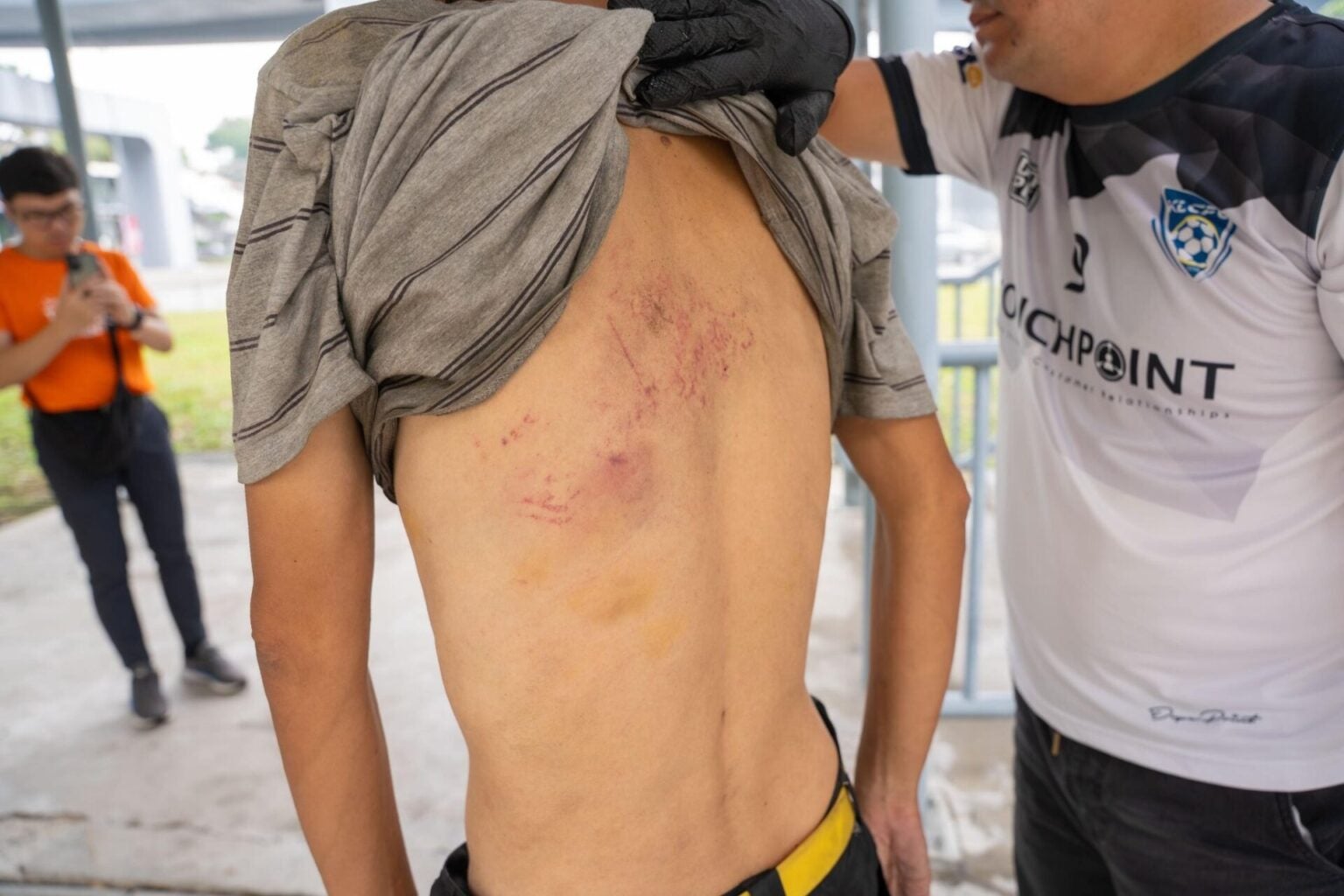 Uncle Kentang Rescues Homeless M'sian Beaten by Robbers, Now Seeking ...